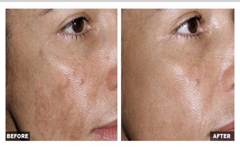 Dermatology-Spectra-&-Crystal - Al Razi Medical Center Qatar | Dental ...